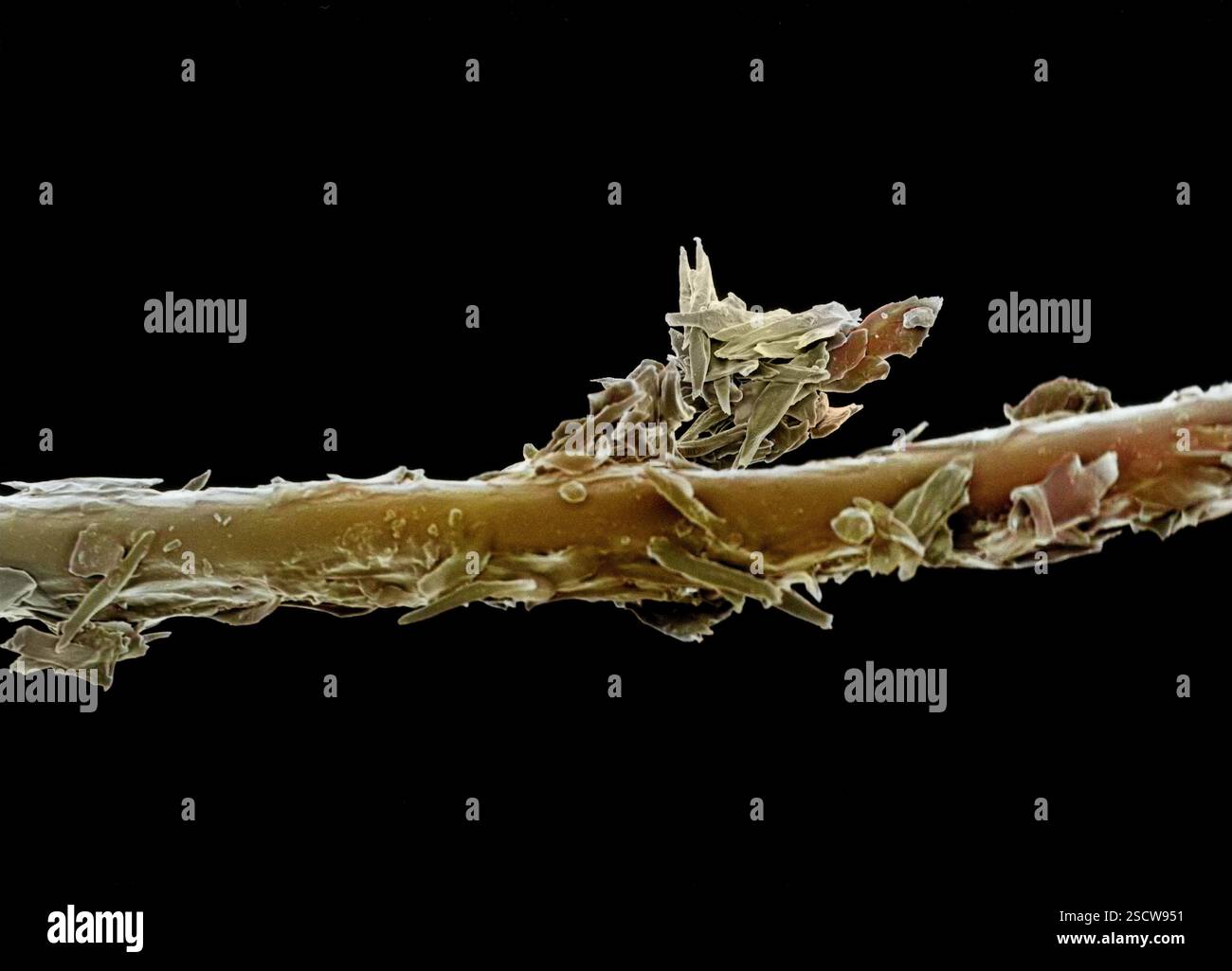 Scanning electron micrograph of animal dander, a common allergen. This ...