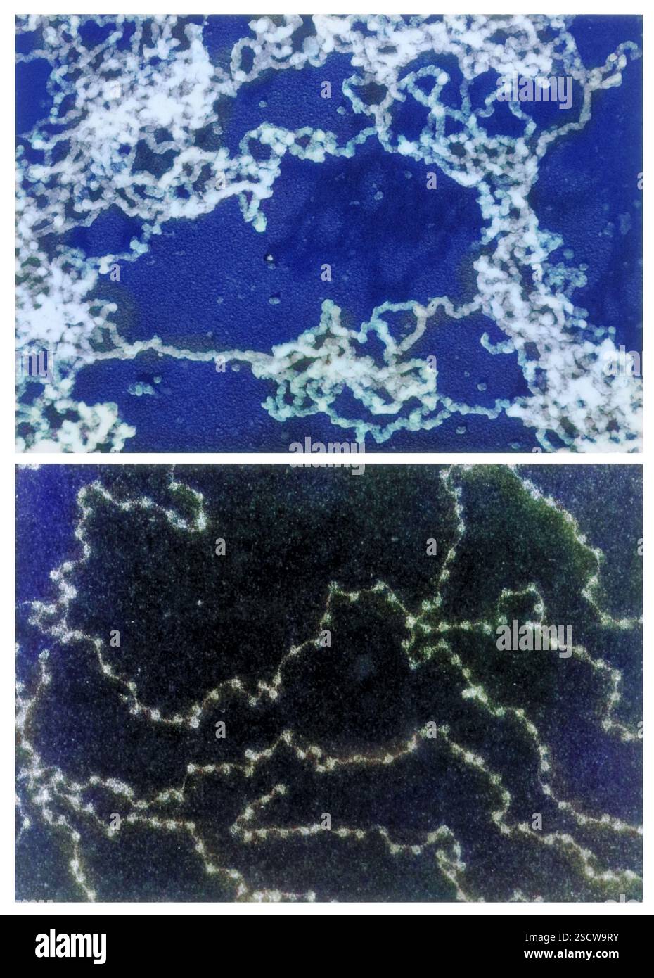 Chromatin fiber micrograph hi-res stock photography and images - Alamy