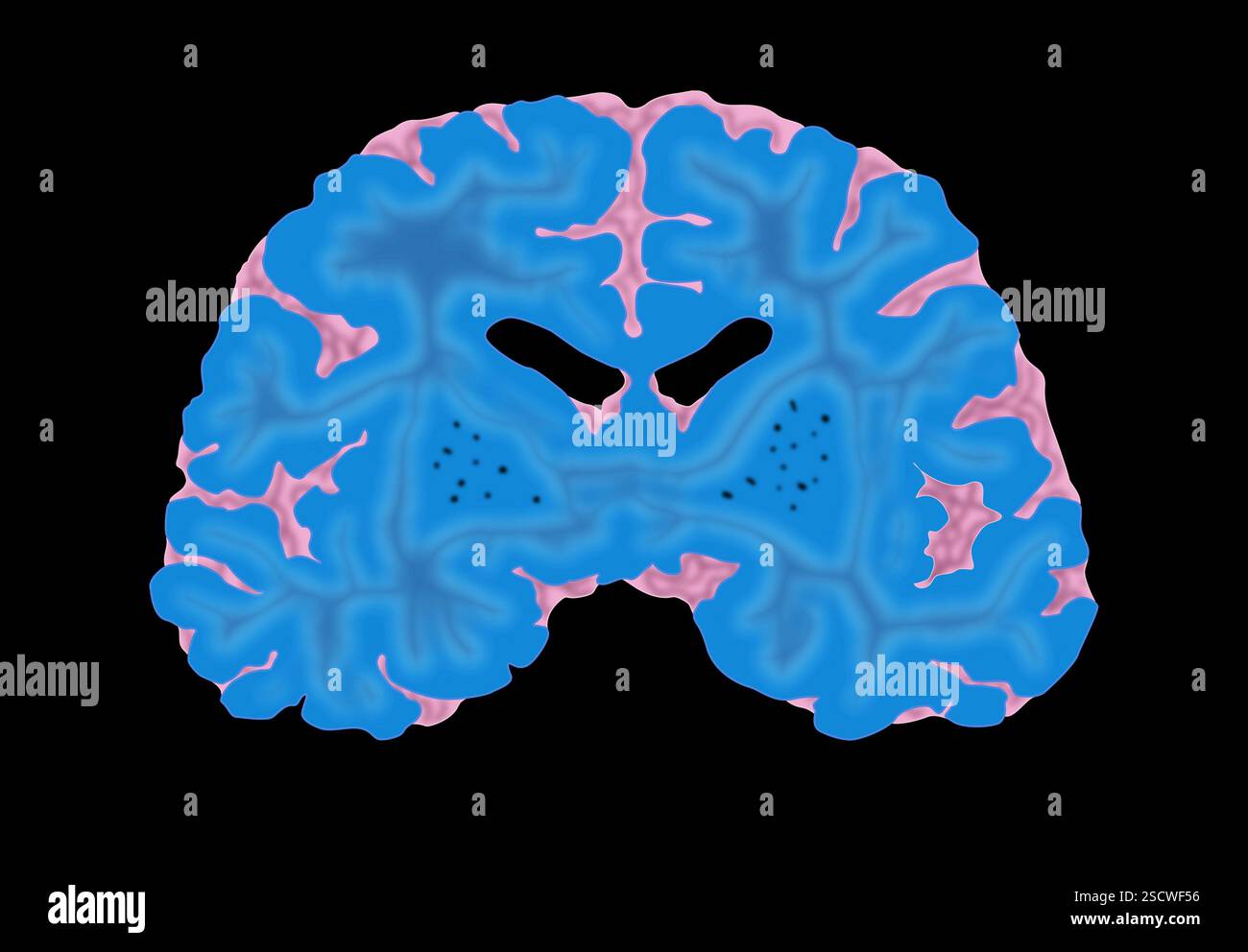 An illustration of a brain slice presenting aspects of a brain with ...