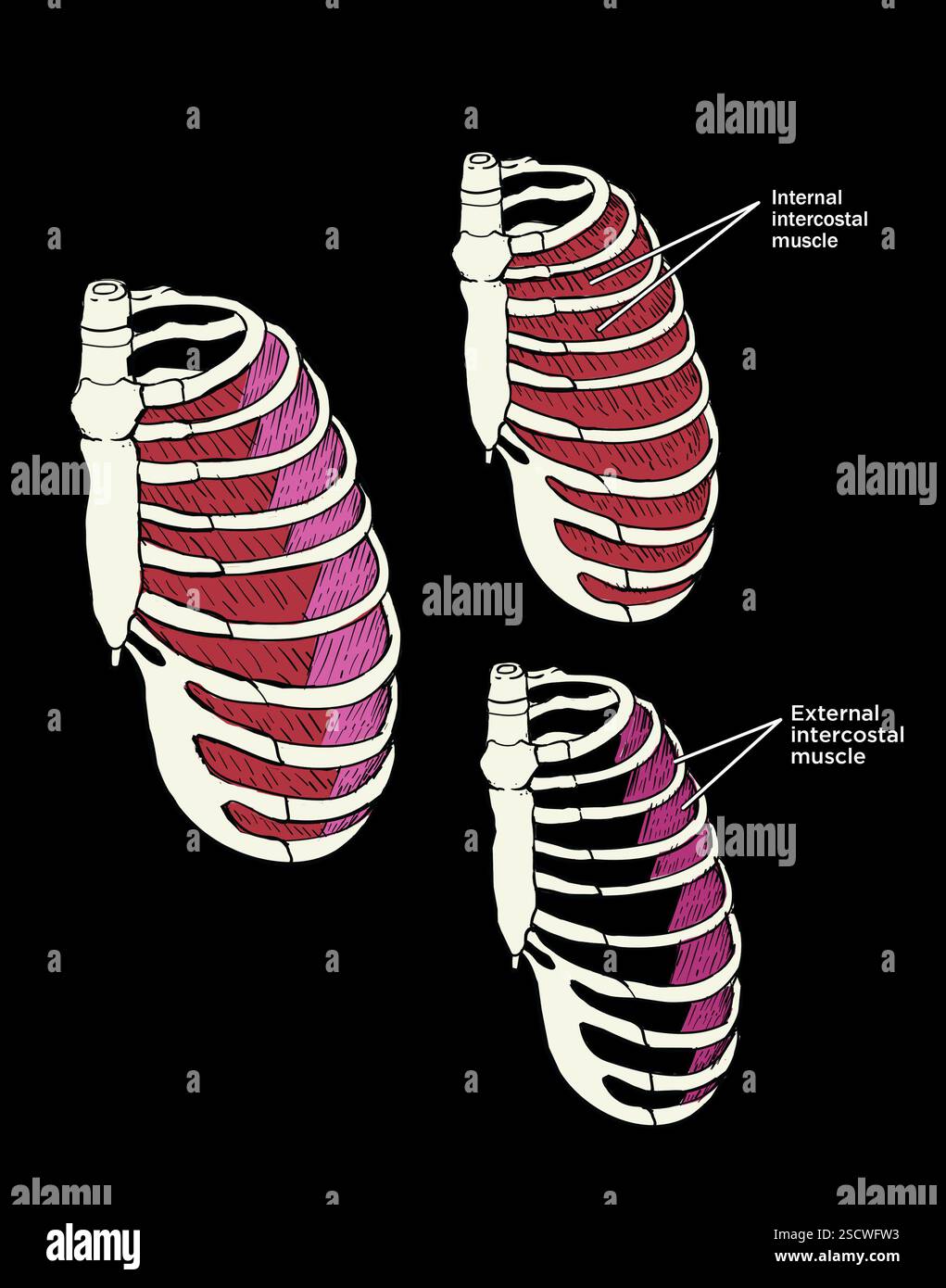 Internal Intercostal Muscle