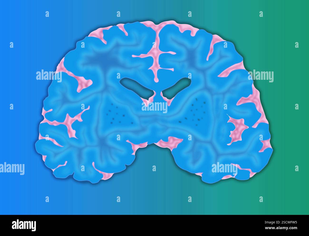 An illustration of a brain slice presenting aspects of a brain with ...