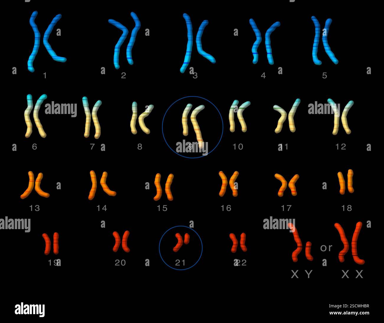 Philadelphia karyotype. Illustration of a male or female karyotype ...