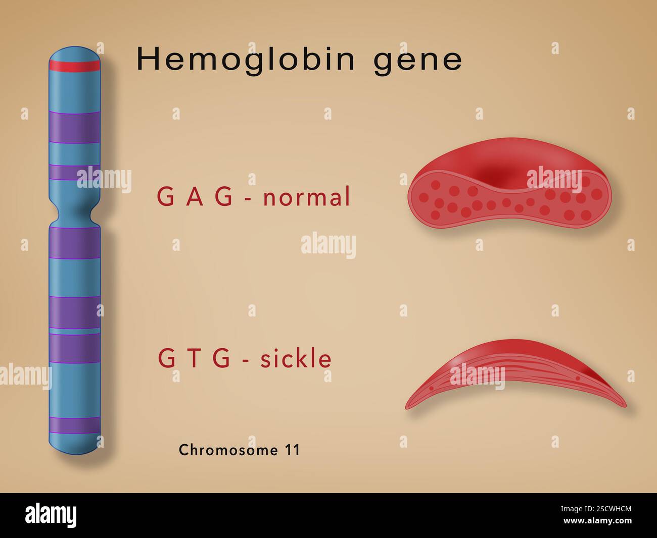Sickle Cell Disease is a recessive genetic disorder. An illustration ...