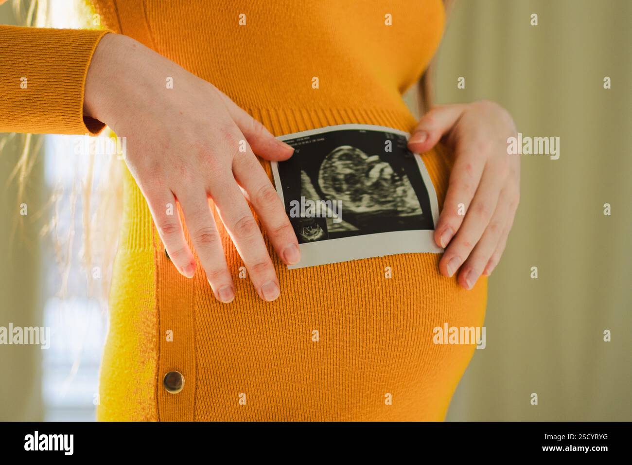 Prenatal ultrasound screening. Pregnant woman hands holding sonogram ...