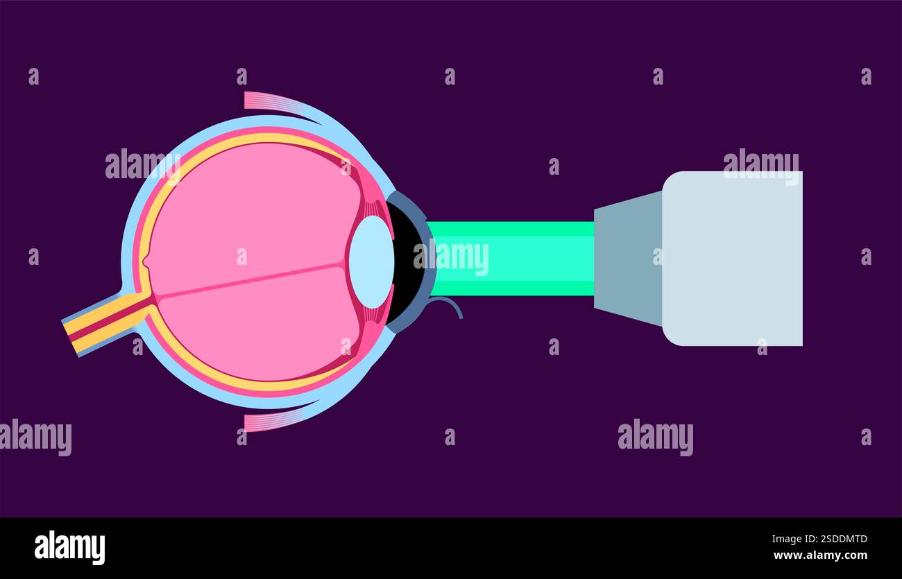 Laser medical device front hi-res stock photography and images - Alamy