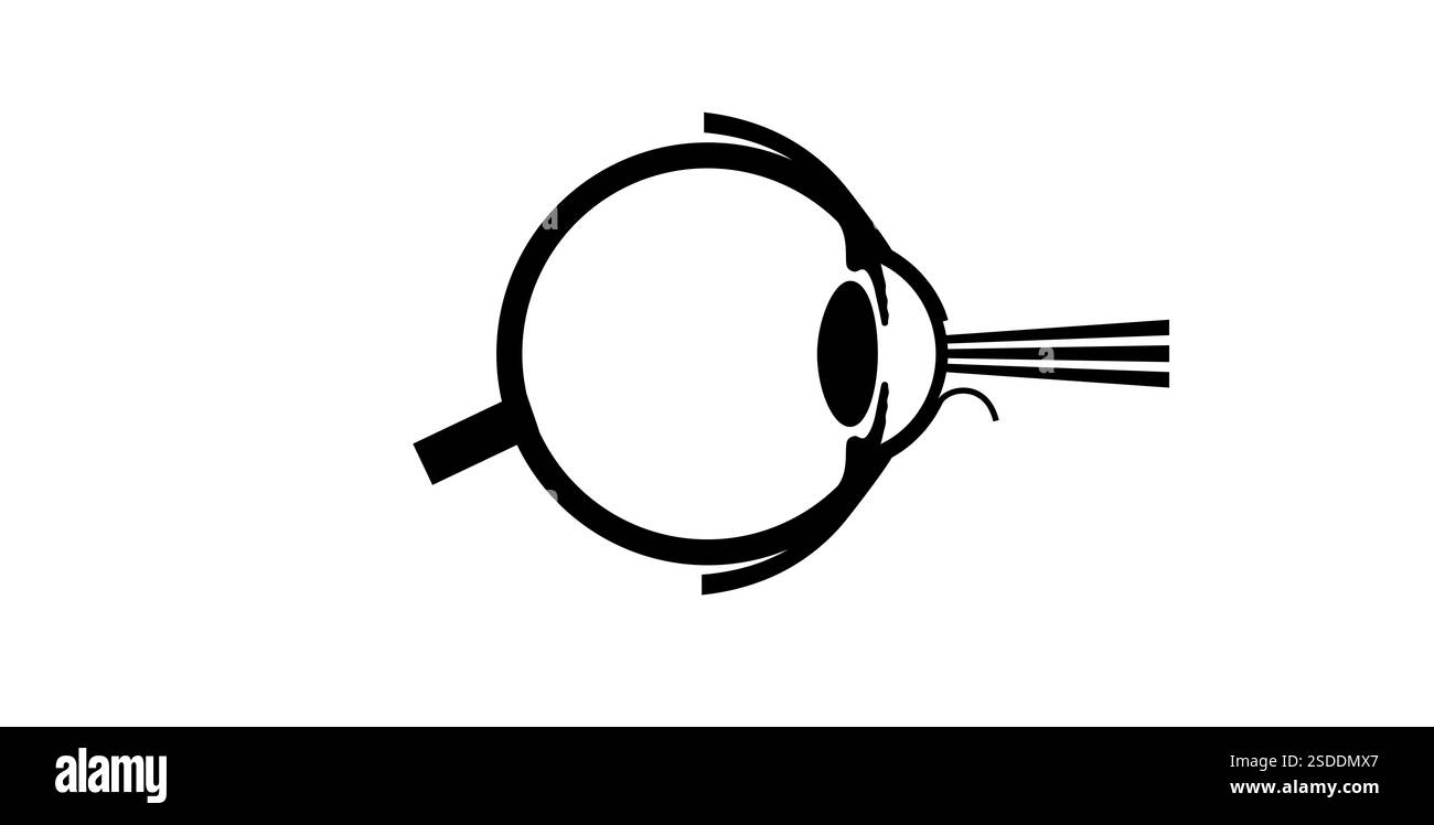 Illustration of laser eye surgery. This is an advanced surgical ...