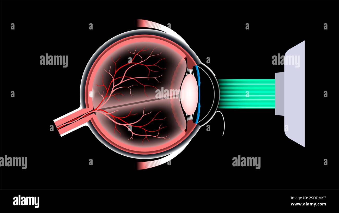 Laser medical device front hi-res stock photography and images - Alamy