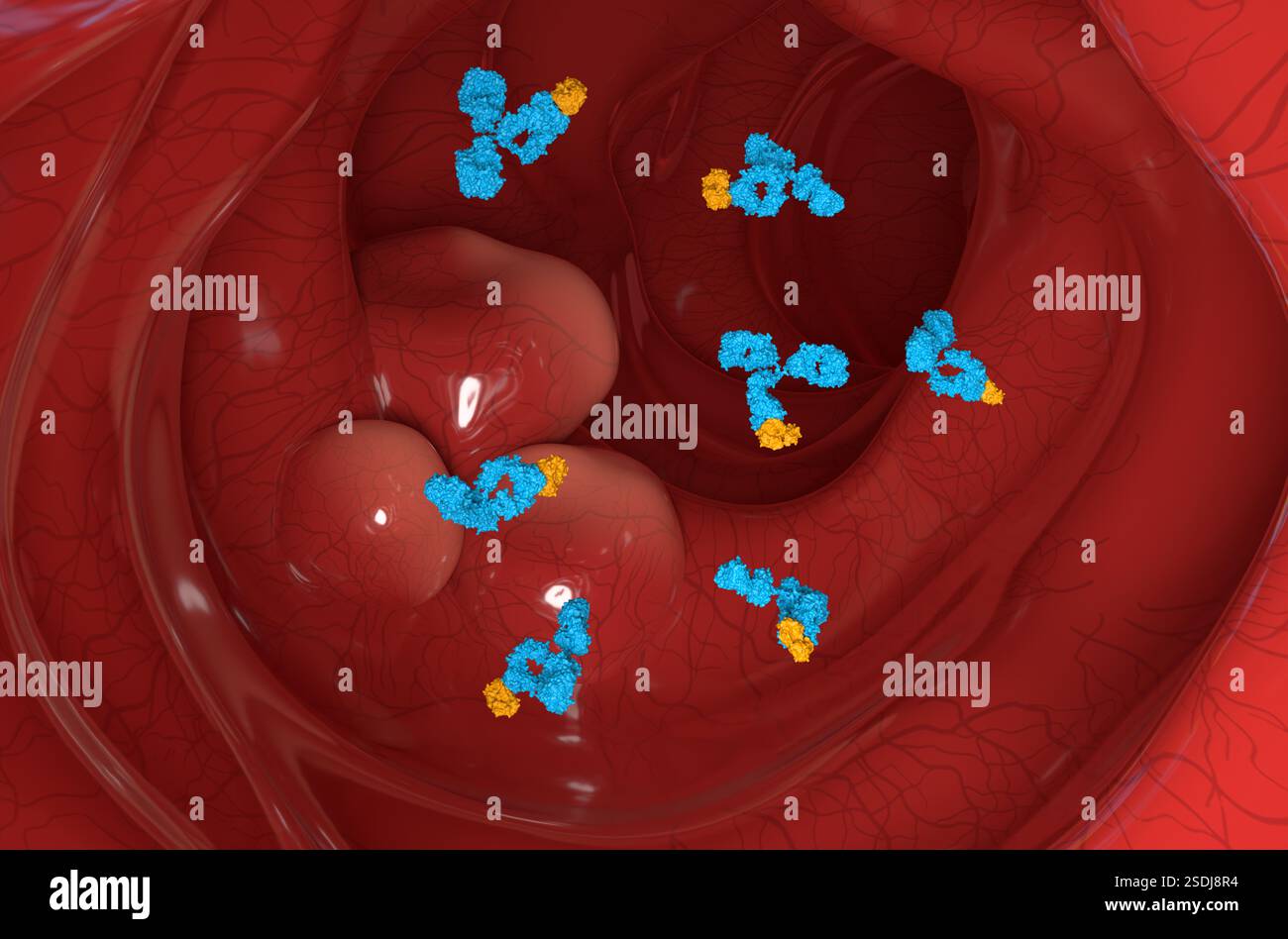 Monoclonal antibody treatment in Colon, Colorectal cancer (CRC ...