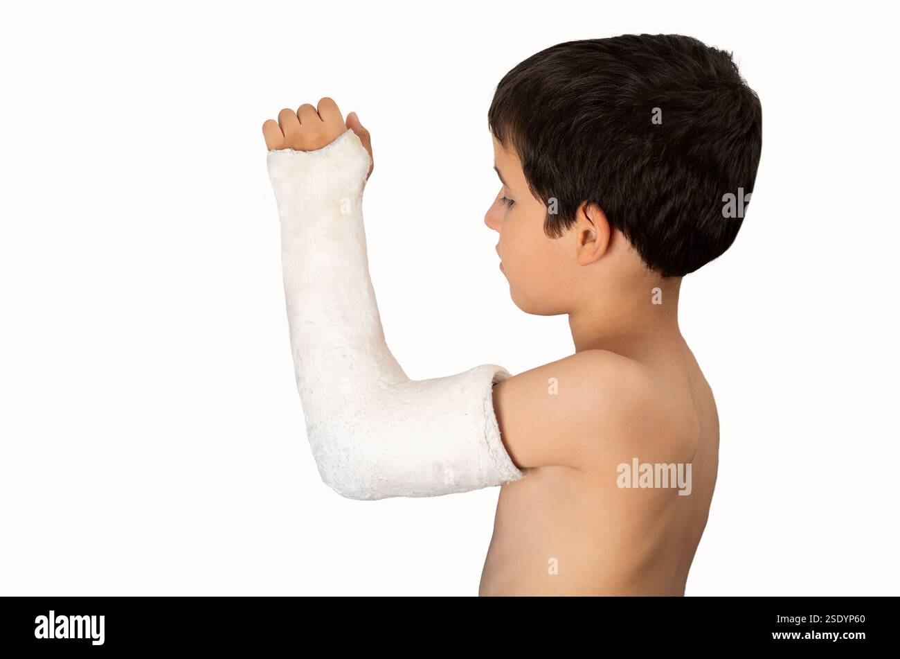 Boy with broken arm in cast isolated with white background Stock Photo ...