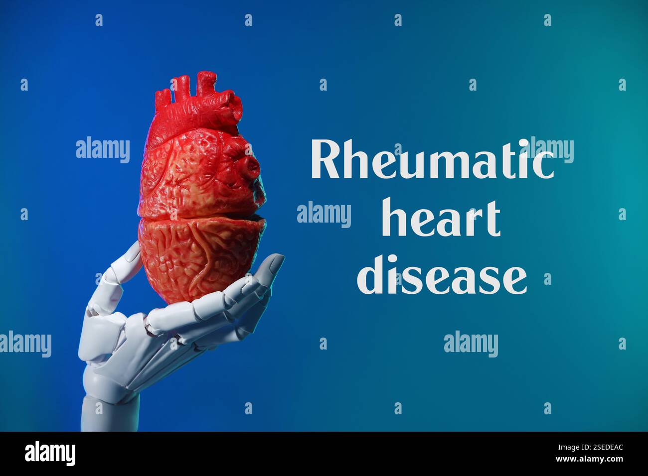 Rheumatism. Robot hand holding model of human heart on blue gradient ...