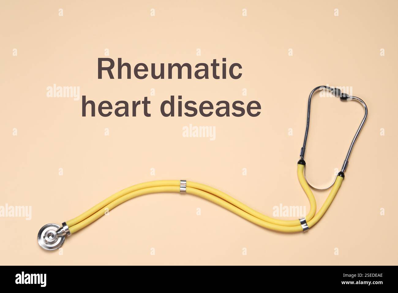 Rheumatism. Stethoscope and words Rheumatic Heart Disease on beige ...