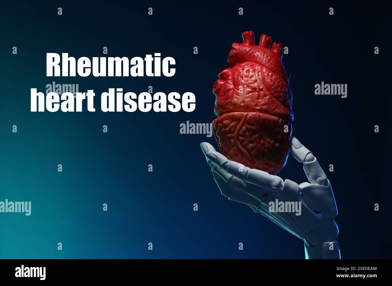 Rheumatism. Robot hand holding model of human heart on blue gradient ...