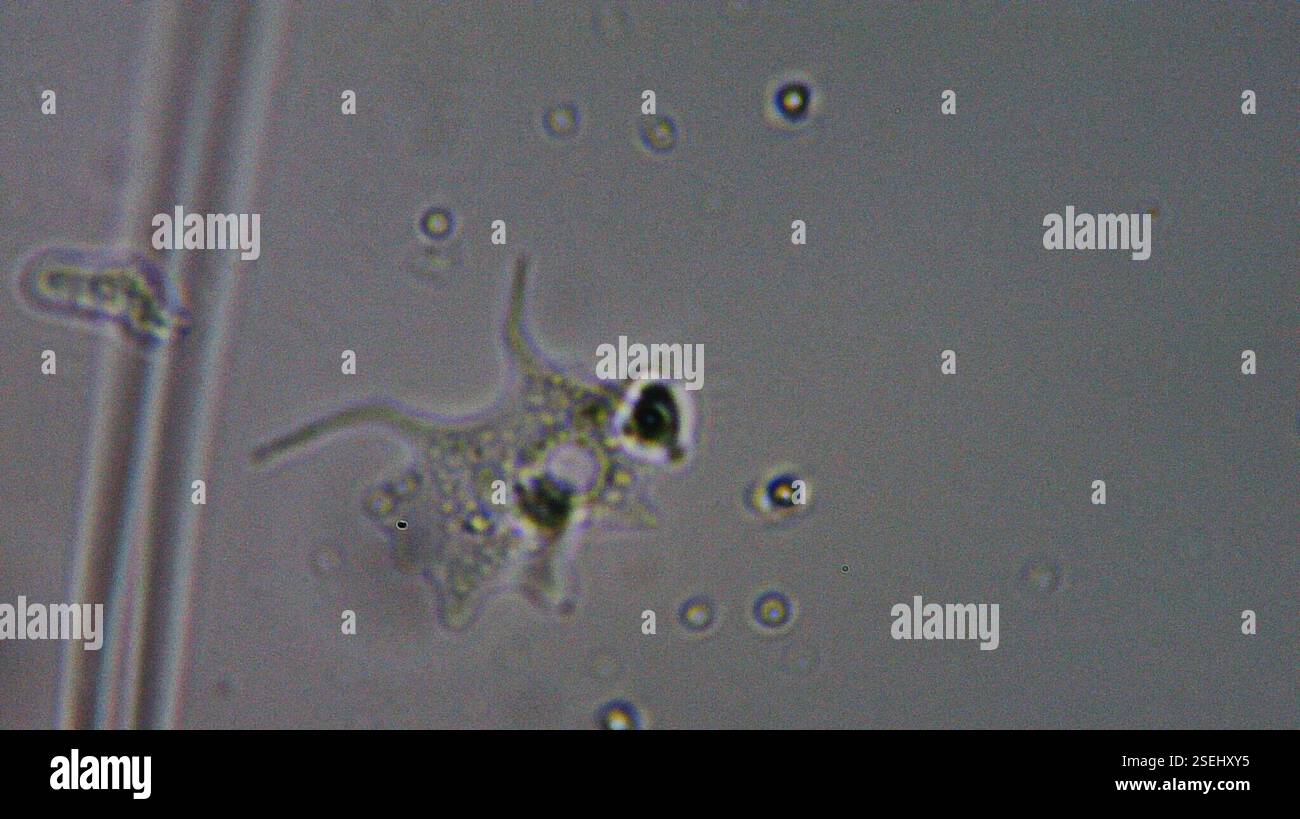Lobose amoebae (Lobosa), Protozoa, Funado, Itabashi City, Tokyo 174 ...