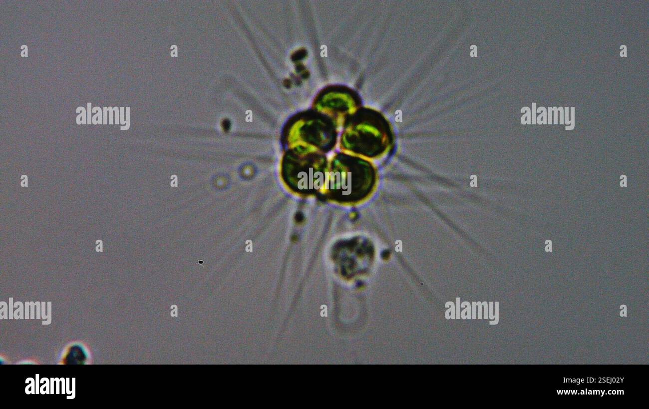 (Micractinium pusillum), Plantae, Ukima, Kita City, Tokyo 115-0051 ...
