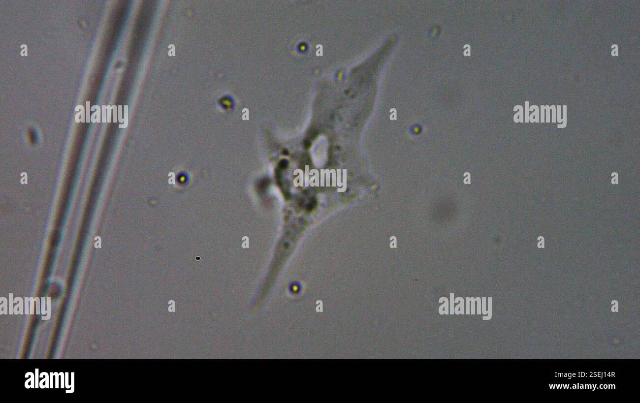 Lobose amoebae (Lobosa), Protozoa, Funado, Itabashi City, Tokyo 174 ...