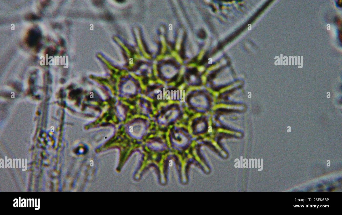 (Pediastrum duplex), Plantae, Ukima, Kita City, Tokyo 115-0051, Japan ...