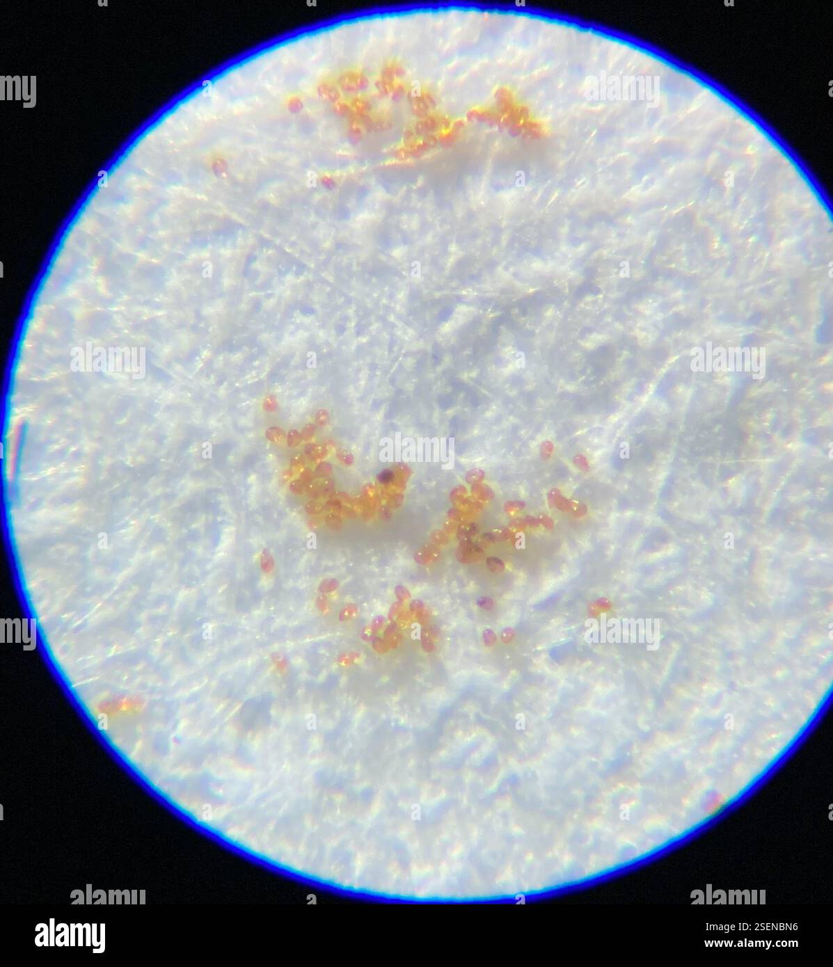 Orange-Yellow Rusts (Puccinia), Fungi, Florida, US, on st augustine ...