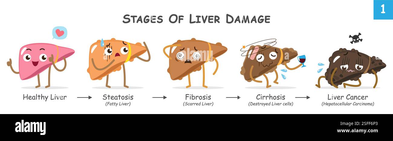 Stages of liver damage . Collection of cute medical cartoon characters ...