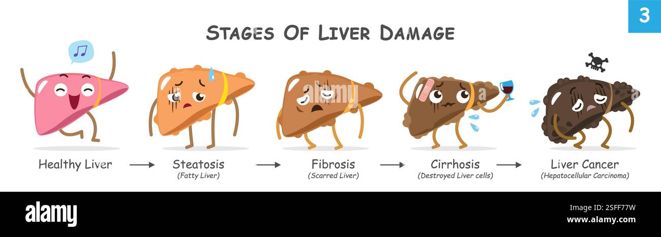 Stages of liver damage . Collection of cute medical cartoon characters ...