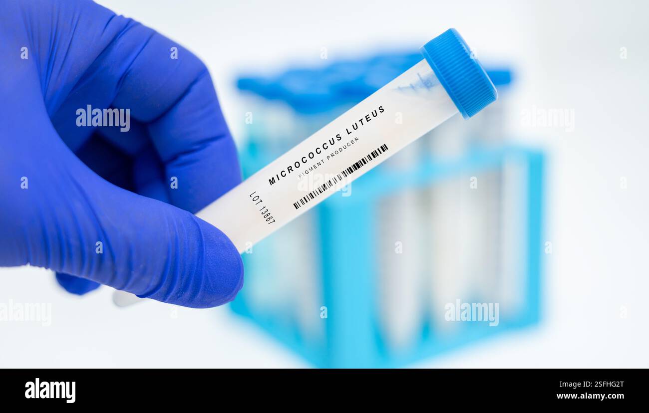 Micrococcus luteus Pigment producer Produces yellow pigments, studied ...