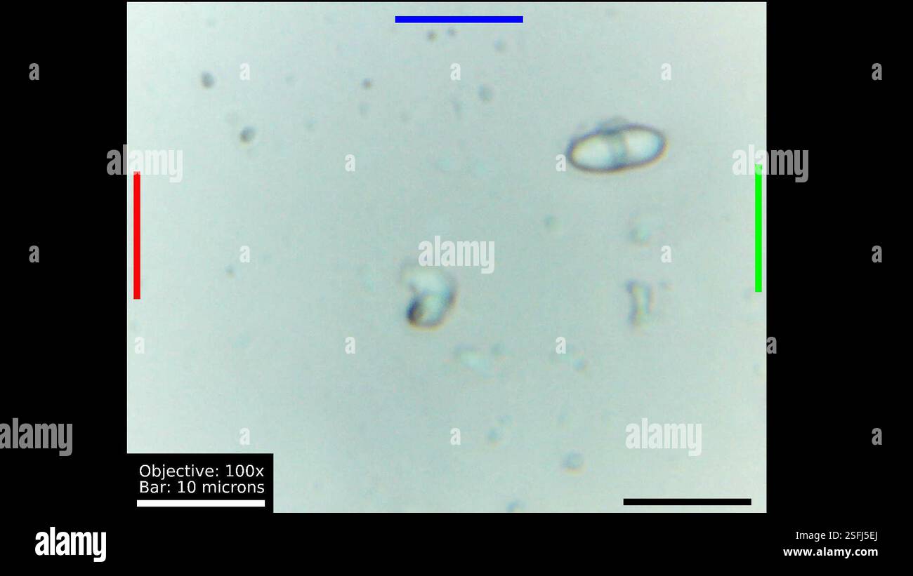 Fungi Including Lichens (Fungi), Fungi, Araçariguama, SP, 18147-000 ...