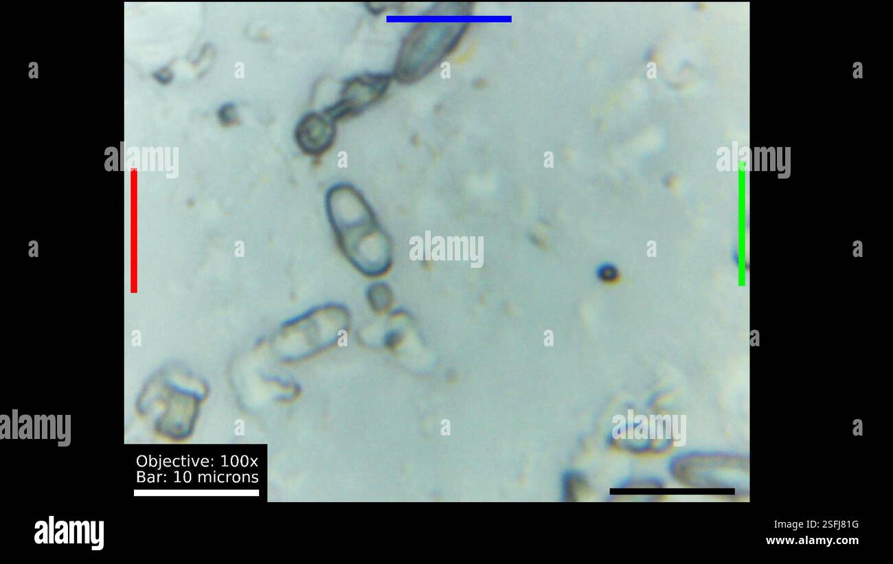 Fungi Including Lichens (Fungi), Fungi, Araçariguama, SP, 18147-000 ...