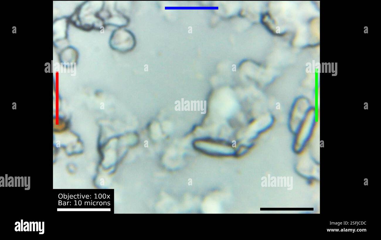 Fungi Including Lichens (Fungi), Fungi, Araçariguama, SP, 18147-000 ...