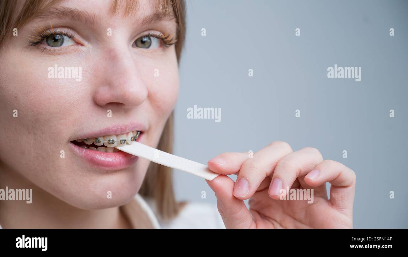 Young woman with metal braces on her teeth is chewing gum. The girl is ...