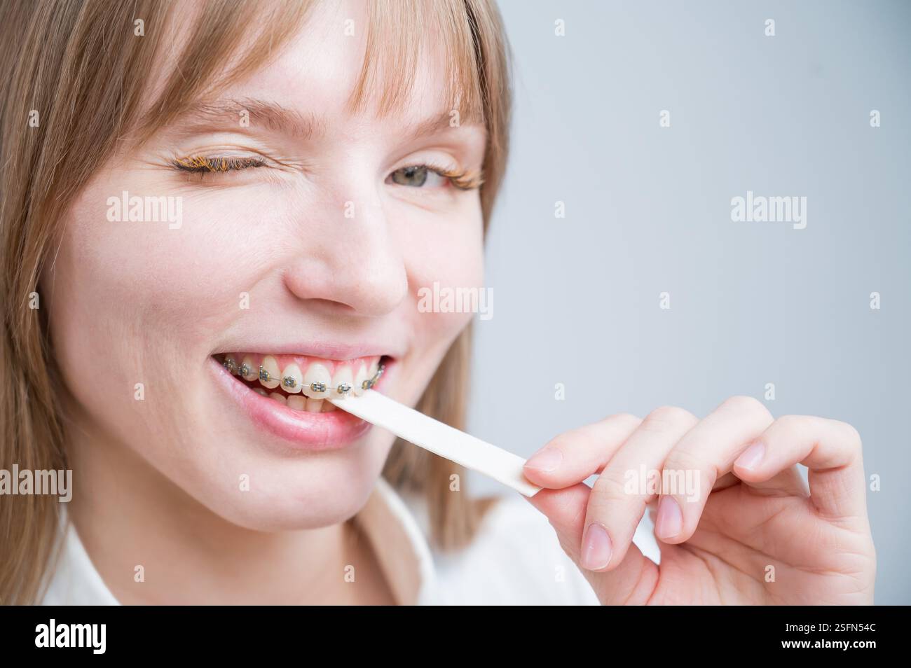Young woman with metal braces on her teeth is chewing gum. The girl is ...