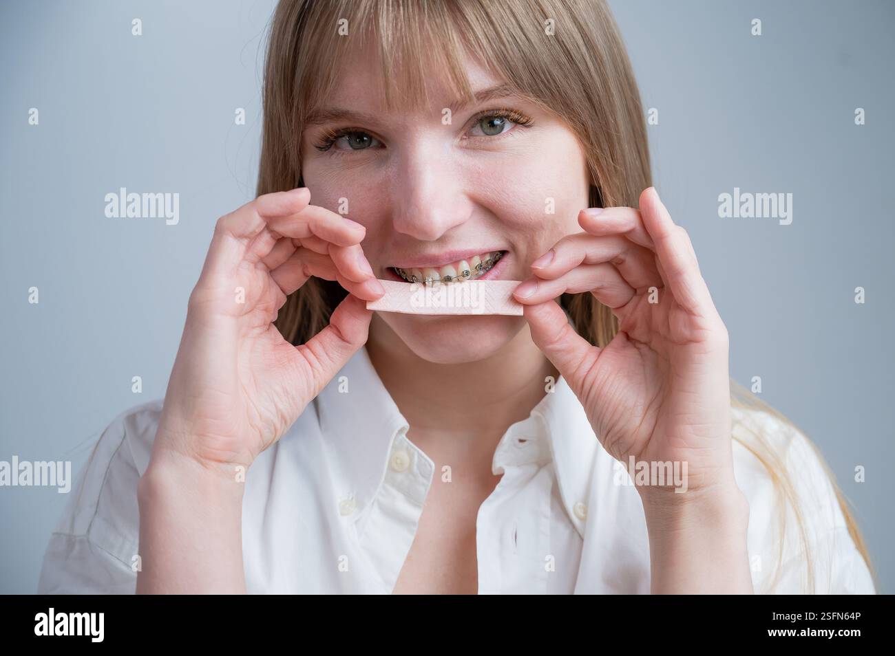 Young woman with metal braces on her teeth is chewing gum. The girl is ...