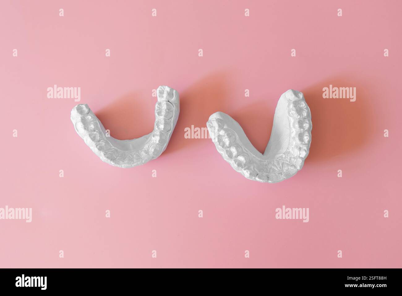Dental casting gypsum model of human jaws on pink background. Crooked ...