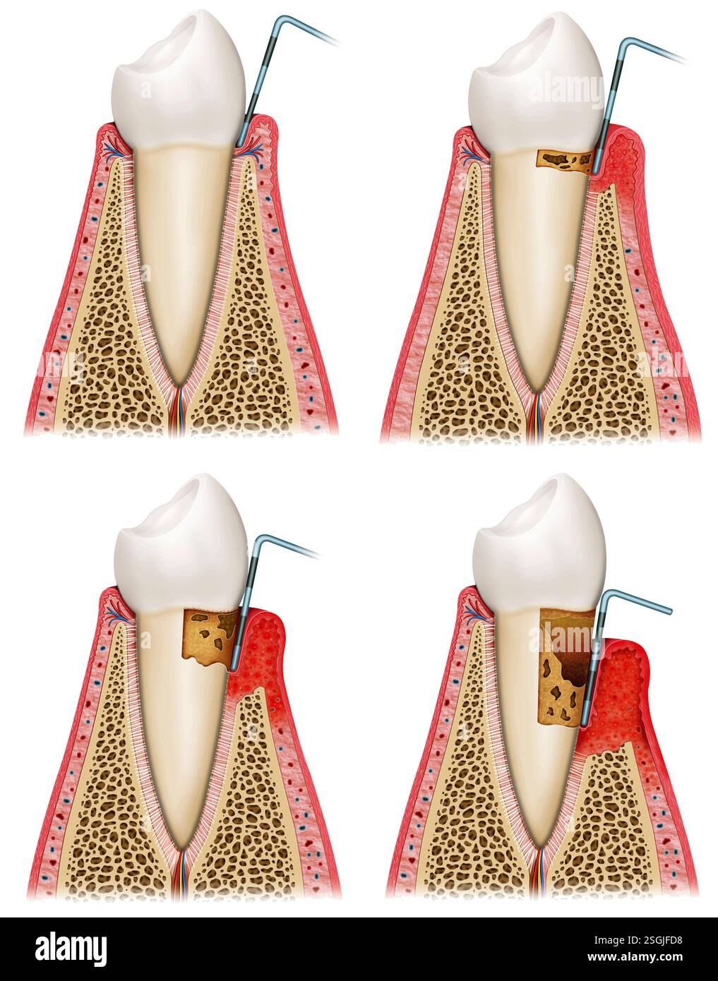 Representation of the sequence of the different stages of a tooth ...