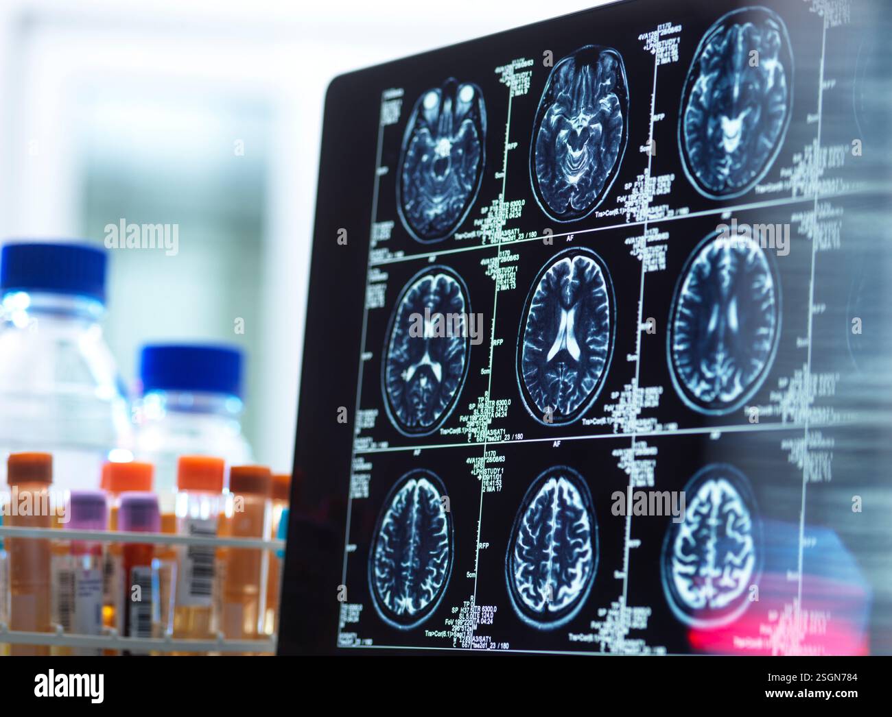 MRI scan of a patient awaiting analyst by a doctor for ageing or damage ...