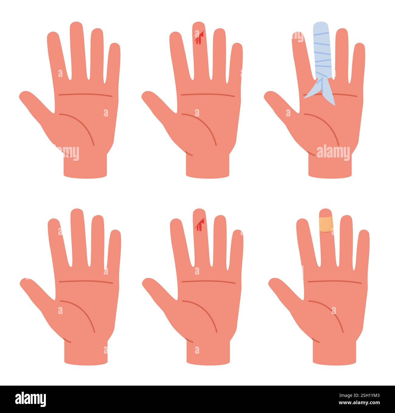 Ways to treat cut. Hand bleeding wound treatment stages process ...