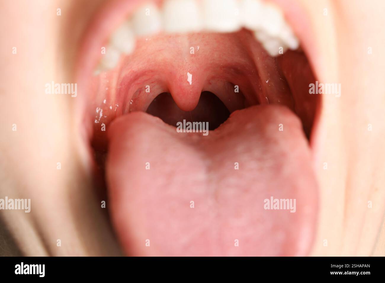 Womans oral health hi-res stock photography and images - Alamy