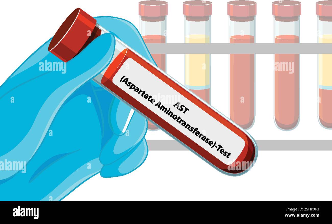 Hand holding a labeled blood test tube Stock Vector Image & Art - Alamy