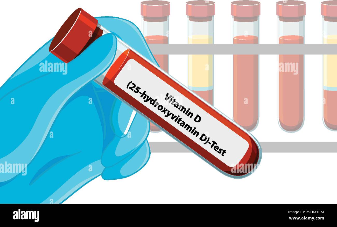 Supplementation Stock Vector Images - Alamy