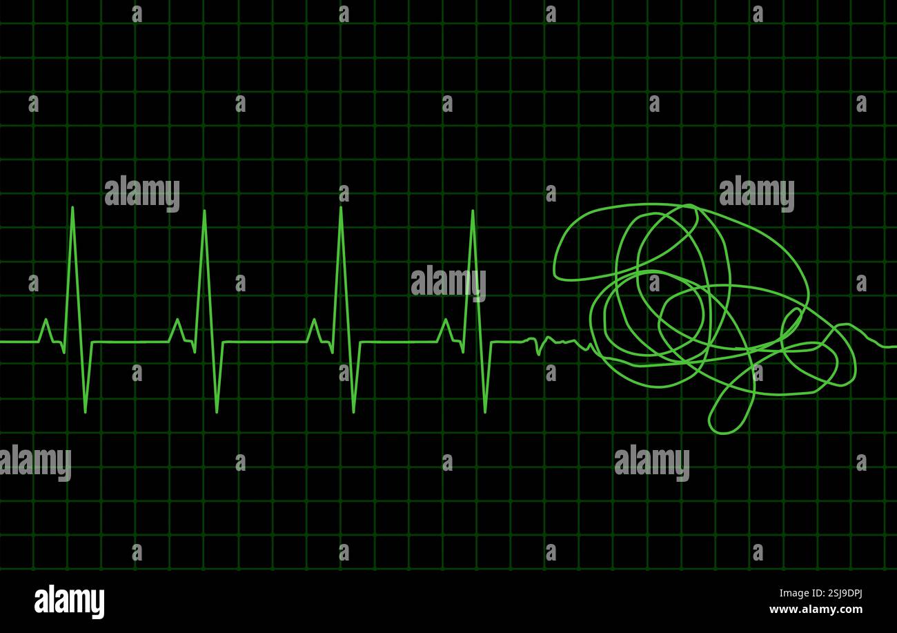 An EKG pattern of ups and downs turns into a tangled line in an ...