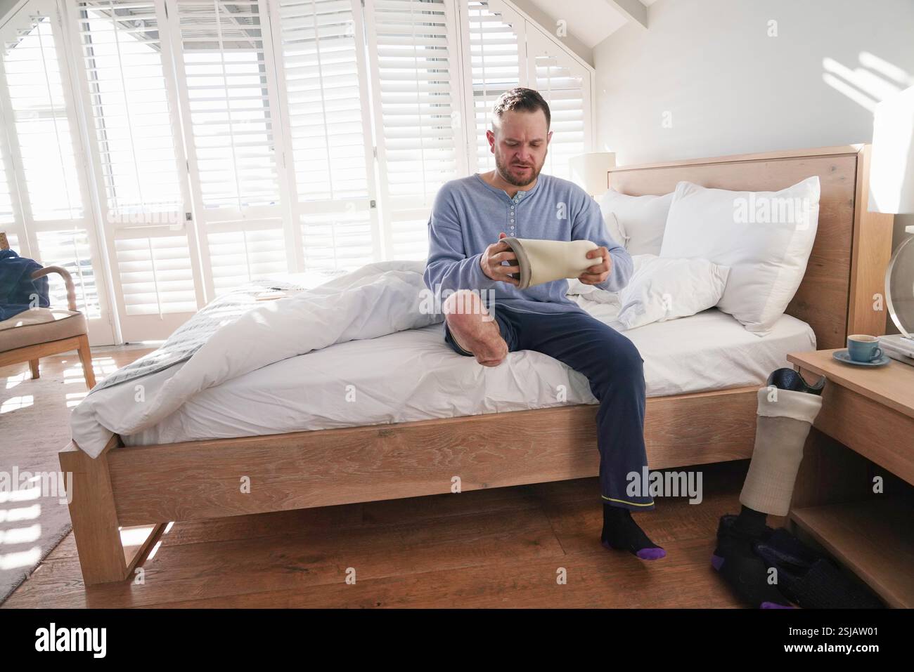 Man attaching leg prosthesis Stock Photo - Alamy