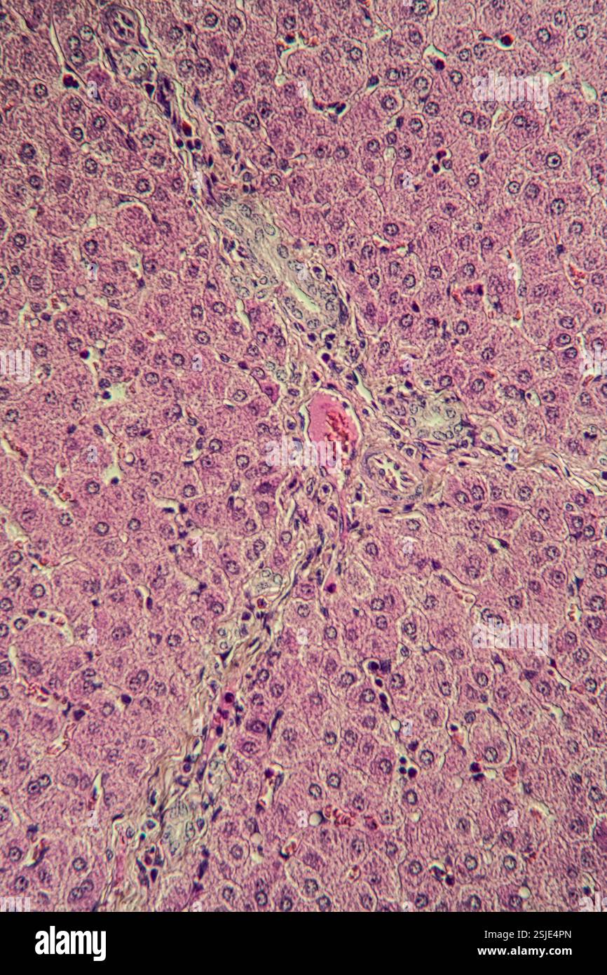 Pork liver section under the microscope 200x Stock Photo - Alamy