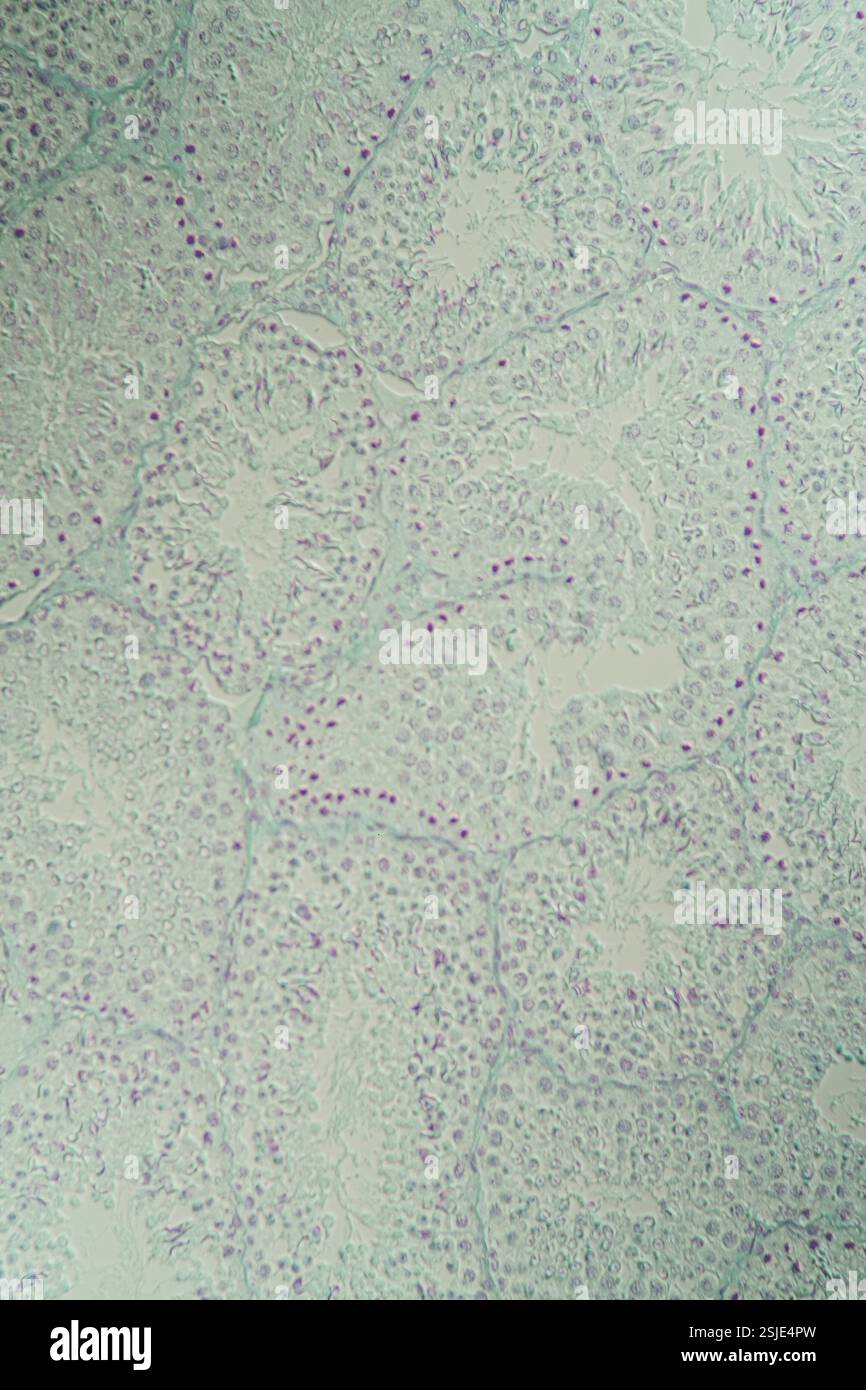 Testicle cross section under the microscope 200x Stock Photo - Alamy