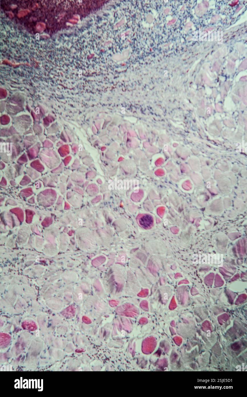 Spore animals in the muscle under the microscope 100x Stock Photo - Alamy