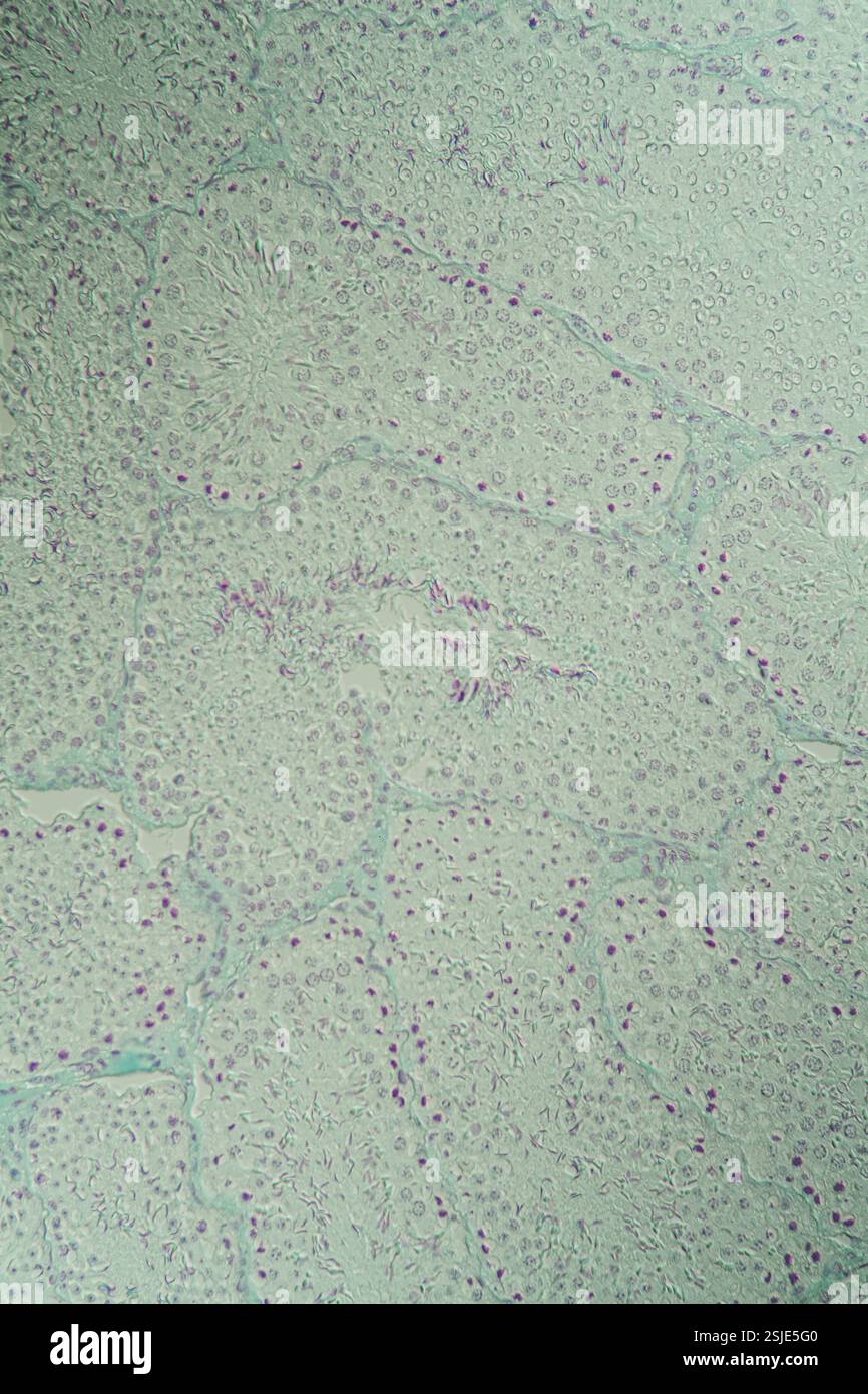Testicle cross section under the microscope 200x Stock Photo - Alamy