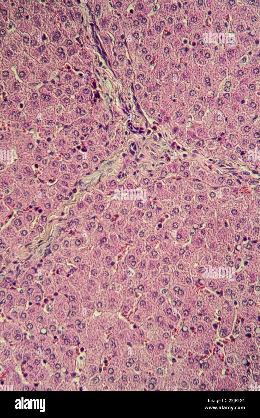 Pork liver section under the microscope 200x Stock Photo - Alamy