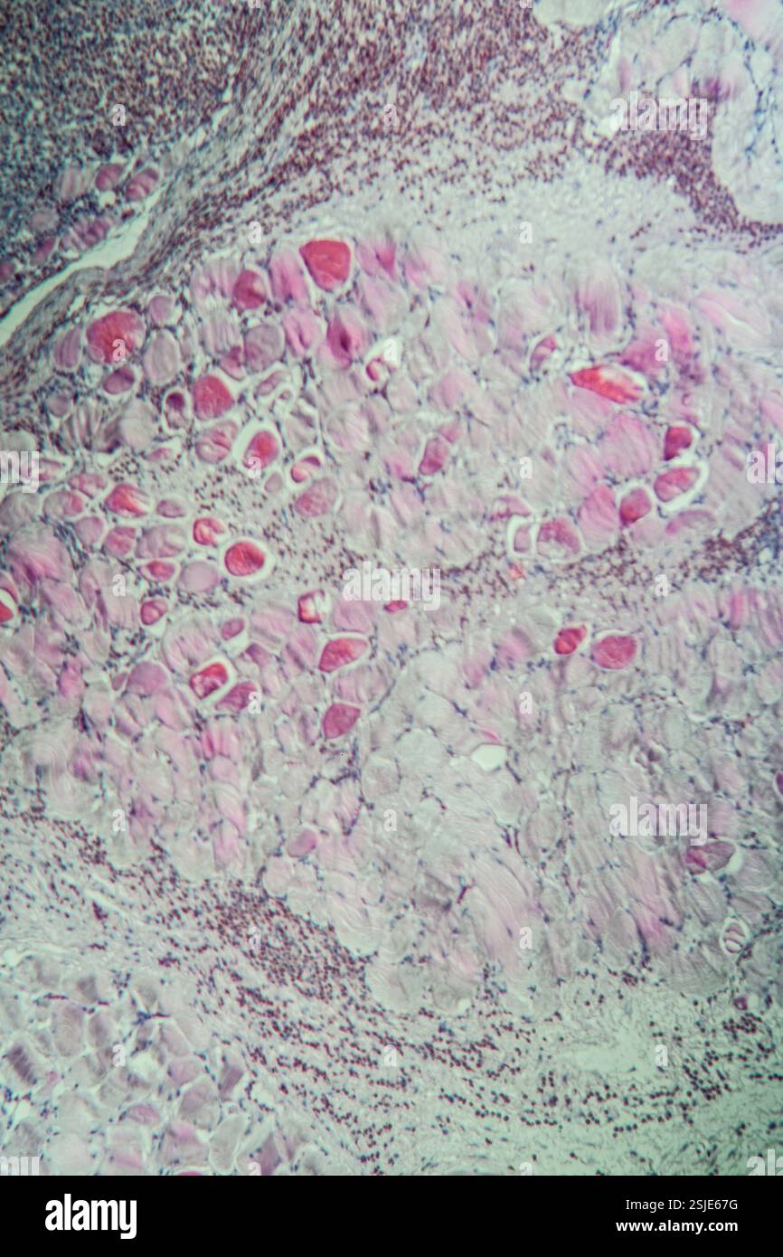 Spore animals in the muscle under the microscope 100x Stock Photo - Alamy