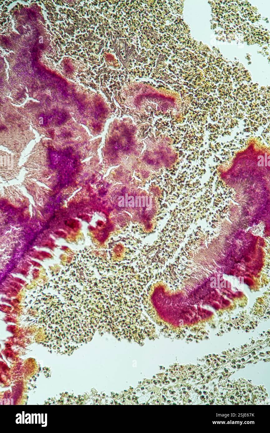 Bacterial disease under the microscope 200x Stock Photo - Alamy