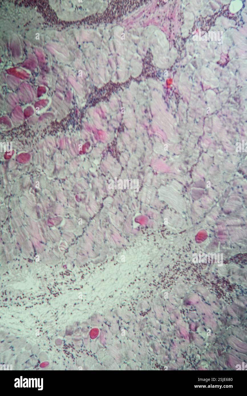 Spore animals in the muscle under the microscope 100x Stock Photo - Alamy