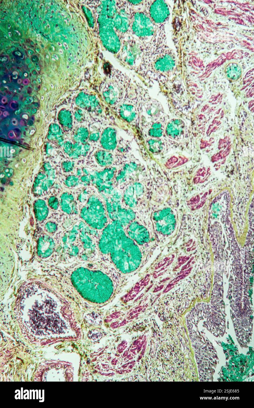 Lung tissue with asthma under the microscope Stock Photo - Alamy