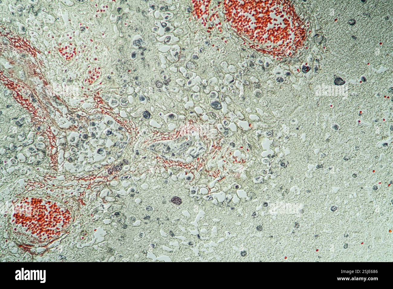 Parasite tissue under the microscope 200x Stock Photo - Alamy