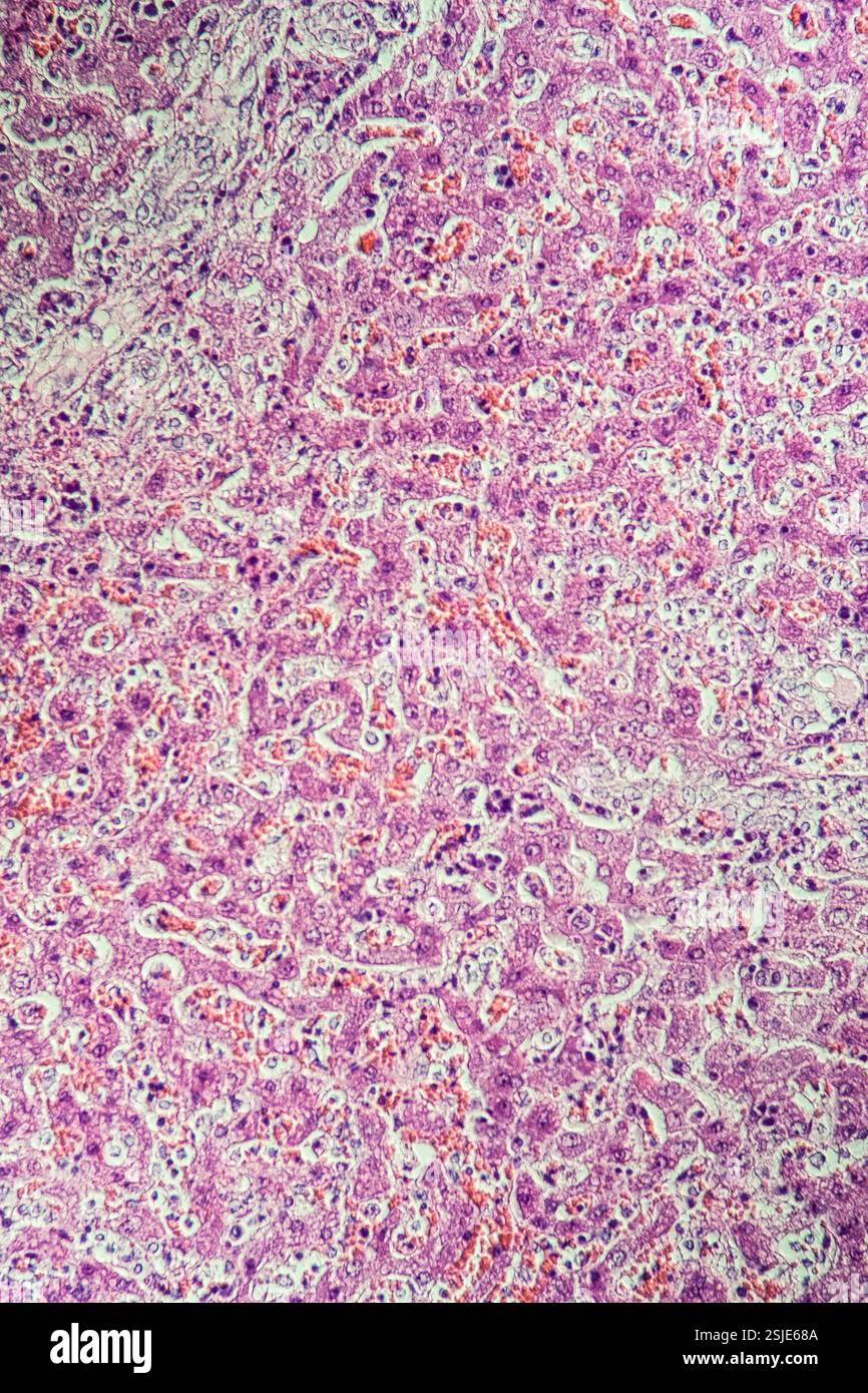 Hedgehog kidney after shock Tissue under the microscope 200x Stock ...